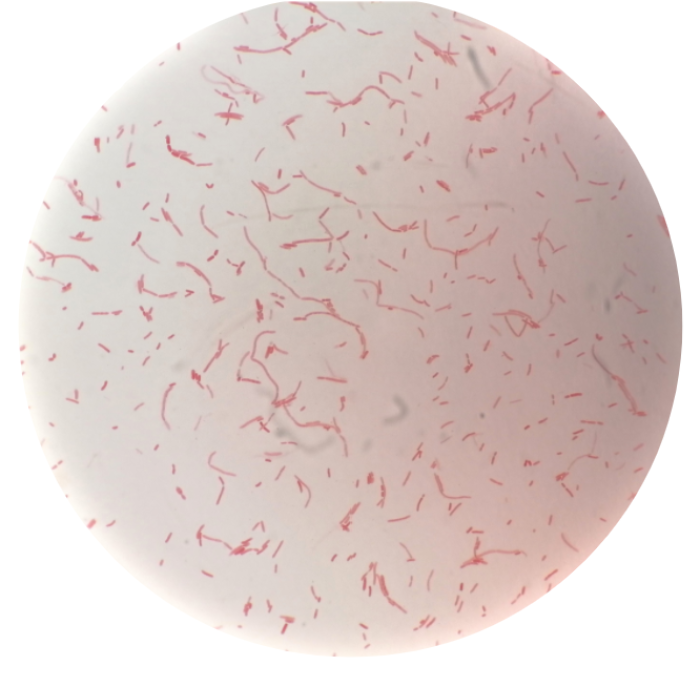Changing requirements for anaerobic culture equipment in microbiome ...