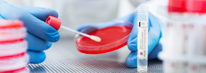 Optimising Sample Collection in Clinical Settings: Best Practices